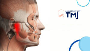 Jaw Clicking: Causes and Treatments - Treat TMJ disorder the right way!